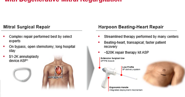 Edwards Lifesciences Expands Portfolio with Harpoon Medical Acquisition