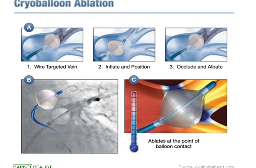 Assessing BSX’s Recently Acquired Cryterion Cryoablation Platform