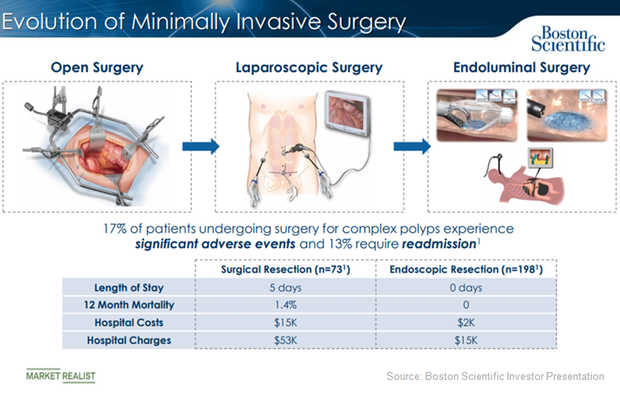 Endoluminal Surgery May Be Opportunity for Boston Scientific