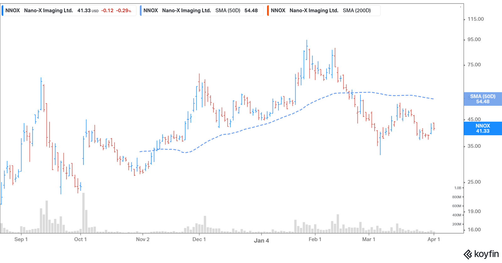 Nano-X Imaging (NNOX) Stock Forecast in 2021: Is It a Good Stock to Buy?